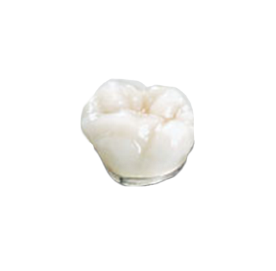 PFMs – East Edge Dental Laboratory